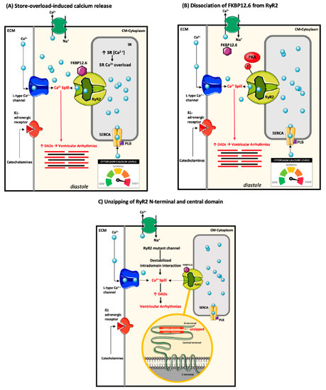 Pediatric Catecholaminergic Polymorphic Ventricular Tachycardia: A ...