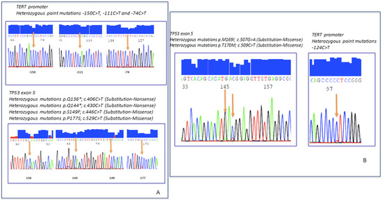 Solitary Fibrous Tumor: Integration of Clinical, Morphologic ...