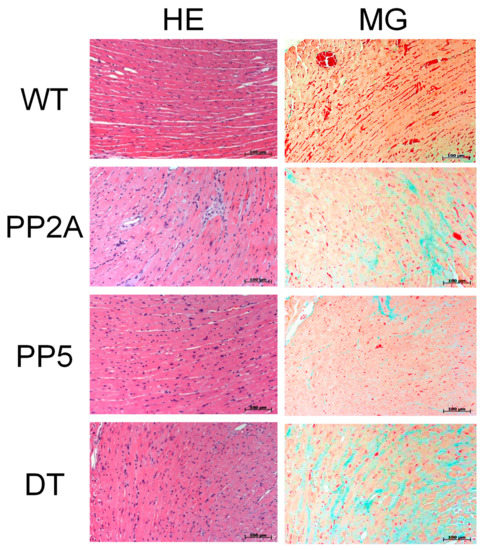 Mechanisms of Systolic Cardiac Dysfunction in PP2A, PP5 and PP2AxPP5 ...