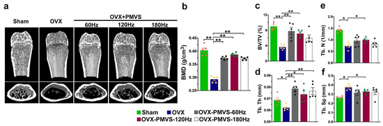 Piezoelectric Microvibration Mitigates Estrogen Loss-Induced ...