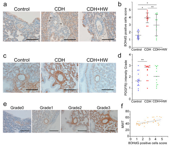 Prenatal Molecular Hydrogen Administration Ameliorates Several Findings ...