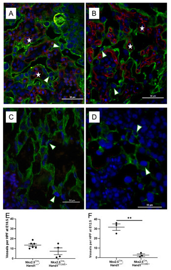 Conditional Mutation of Hand1 in the Mouse Placenta Disrupts Placental ...