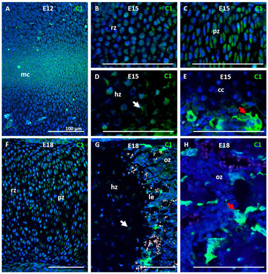Ijms Free Full Text Caspase 1 Inhibition Impacts The Formation Of