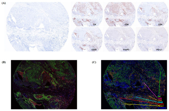 Application of Immunoprofiling Using Multiplexed Immunofluorescence ...