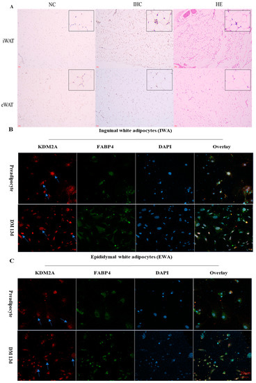 Ablation of KDM2A Inhibits Preadipocyte Proliferation and Promotes ...