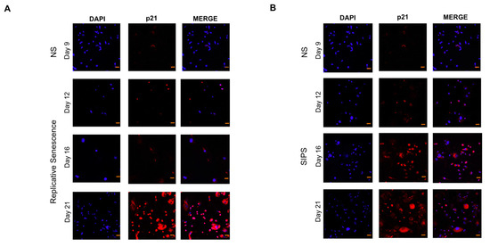 Increased CD47 and MHC Class I Inhibitory Signals Expression in ...
