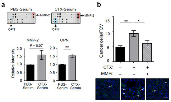Chemotherapy-Induced Changes in the Lung Microenvironment: The Role of ...