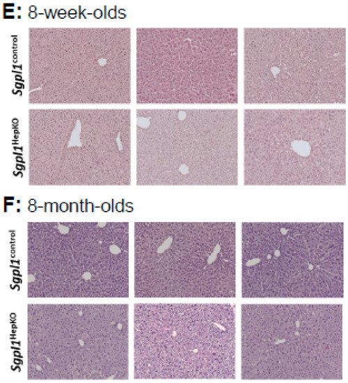 Mouse Liver Compensates Loss of Sgpl1 by Secretion of Sphingolipids ...