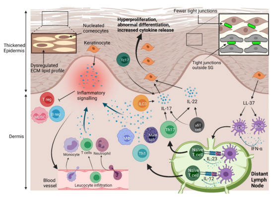 Skin Barrier Dysregulation in Psoriasis