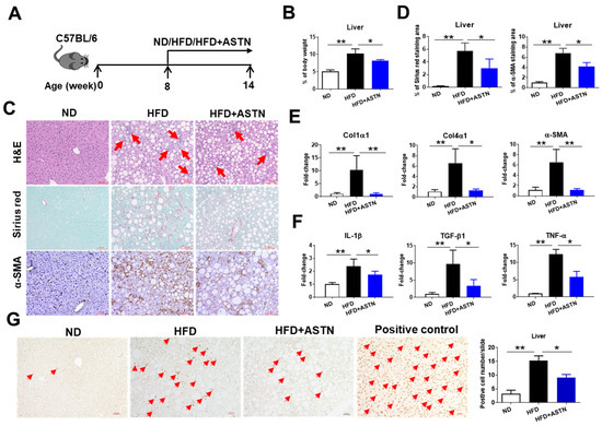 Astaxanthin Prevents Diet-Induced NASH Progression by Shaping ...