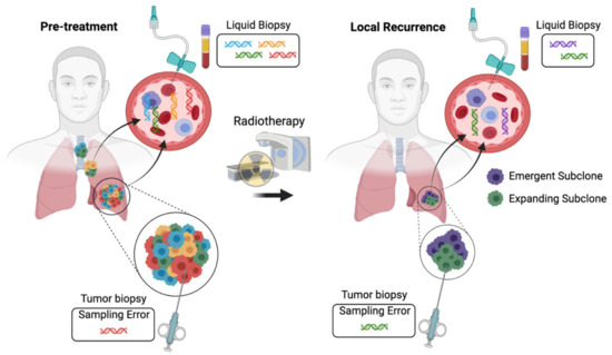 Liquid Biopsies for Molecular Biology-Based Radiotherapy