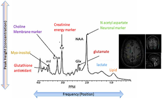IJMS | Free Full-Text | Dynamics of Choline-Containing Phospholipids in ...