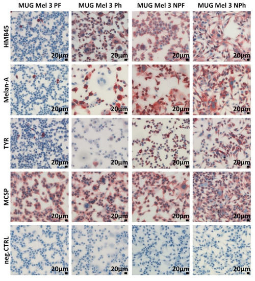 MUG Mel3 Cell Lines Reflect Heterogeneity in Melanoma and Represent a ...