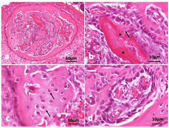 Mechanical Properties of Human Concentrated Growth Factor (CGF ...