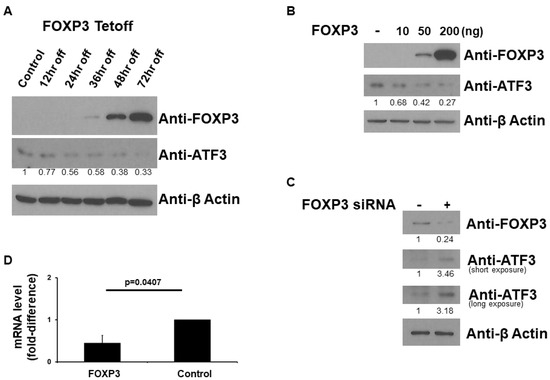 IJMS | Special Issue : Transcriptional Regulation and Its Misregulation ...