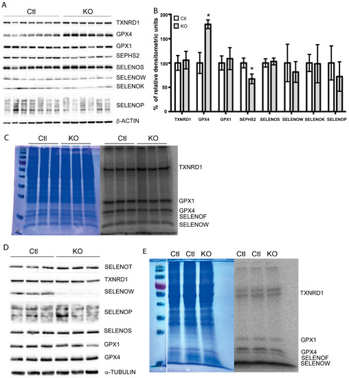 The Effect of tRNA[Ser]Sec Isopentenylation on Selenoprotein Expression