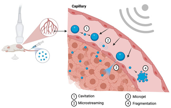 IJMS | Free Full-Text | Applications of Ultrasound-Mediated Drug Delivery and Gene Therapy