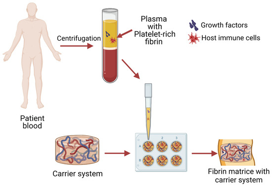 From Blood to Regenerative Tissue: How Autologous Platelet-Rich Fibrin ...