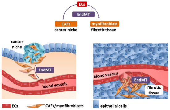 Cytoskeleton Reorganization in EndMT—The Role in Cancer and Fibrotic ...