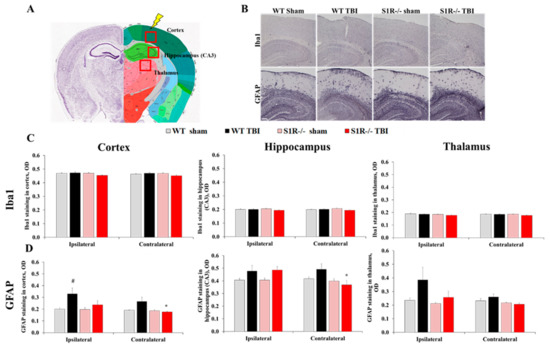 Reduced GFAP Expression in Bergmann Glial Cells in the Cerebellum of ...