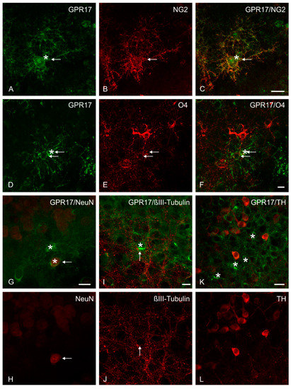 Involvement of GPR17 in Neuronal Fibre Outgrowth