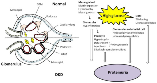 Recent Advances in Diabetic Kidney Diseases: From Kidney Injury to Kidney Fibrosis
