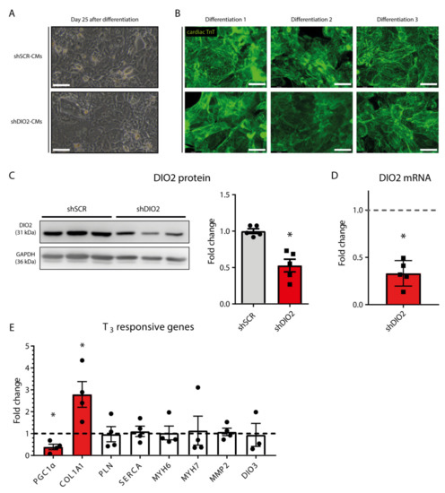 Selenoprotein DIO2 Is a Regulator of Mitochondrial Function, Morphology ...