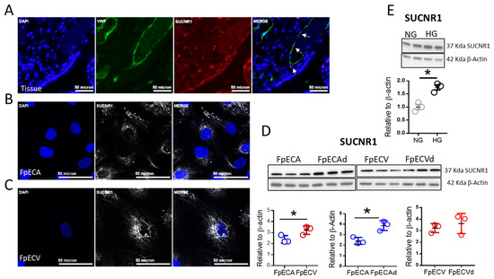 SUCNR1 Is Expressed in Human Placenta and Mediates Angiogenesis ...