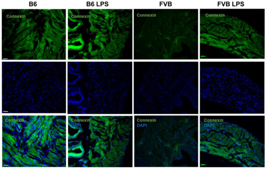 B6 Mouse Strain: The Best Fit for LPS-Induced Interstitial Cystitis Model