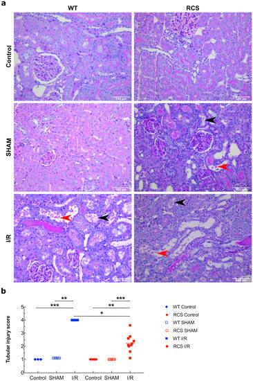 Study of the Role of the Tyrosine Kinase Receptor MerTK in the ...
