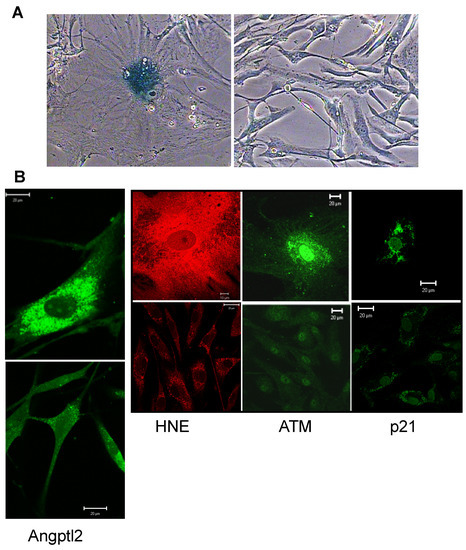 Angptl2 is a Marker of Cellular Senescence: The Physiological and ...