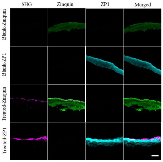 Human Epidermal Zinc Concentrations after Topical Application of ZnO ...
