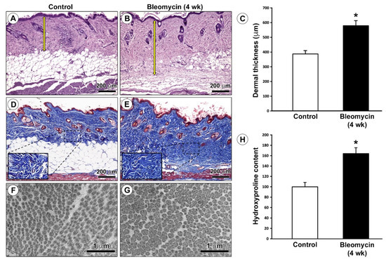 Scleroderma-like Impairment in the Network of Telocytes/CD34+ Stromal ...
