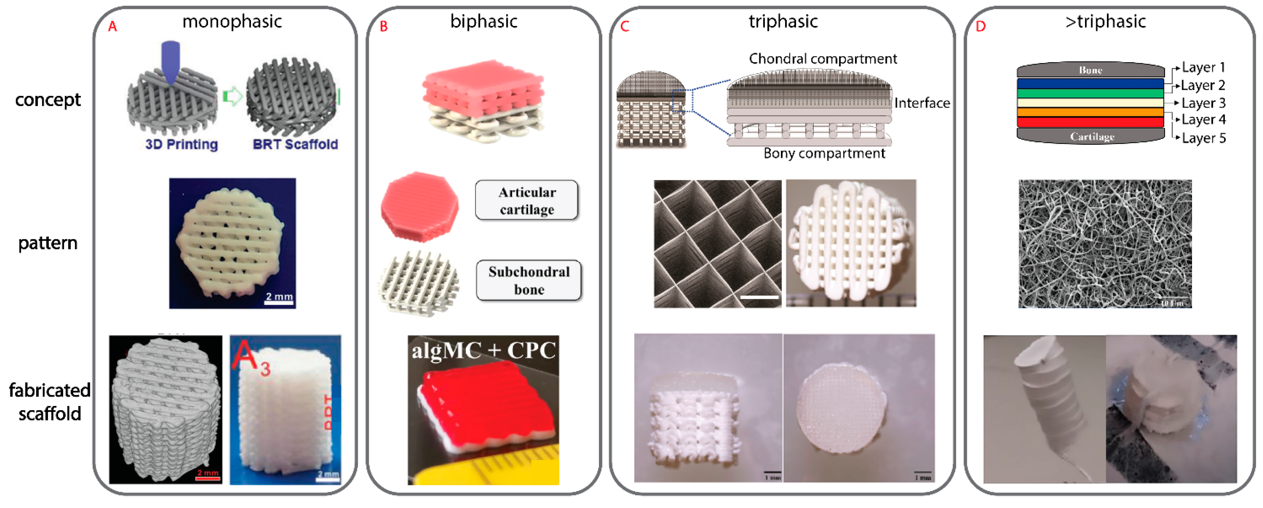 3D Printed Multiphasic Scaffolds for Osteochondral Repair: Challenges ...