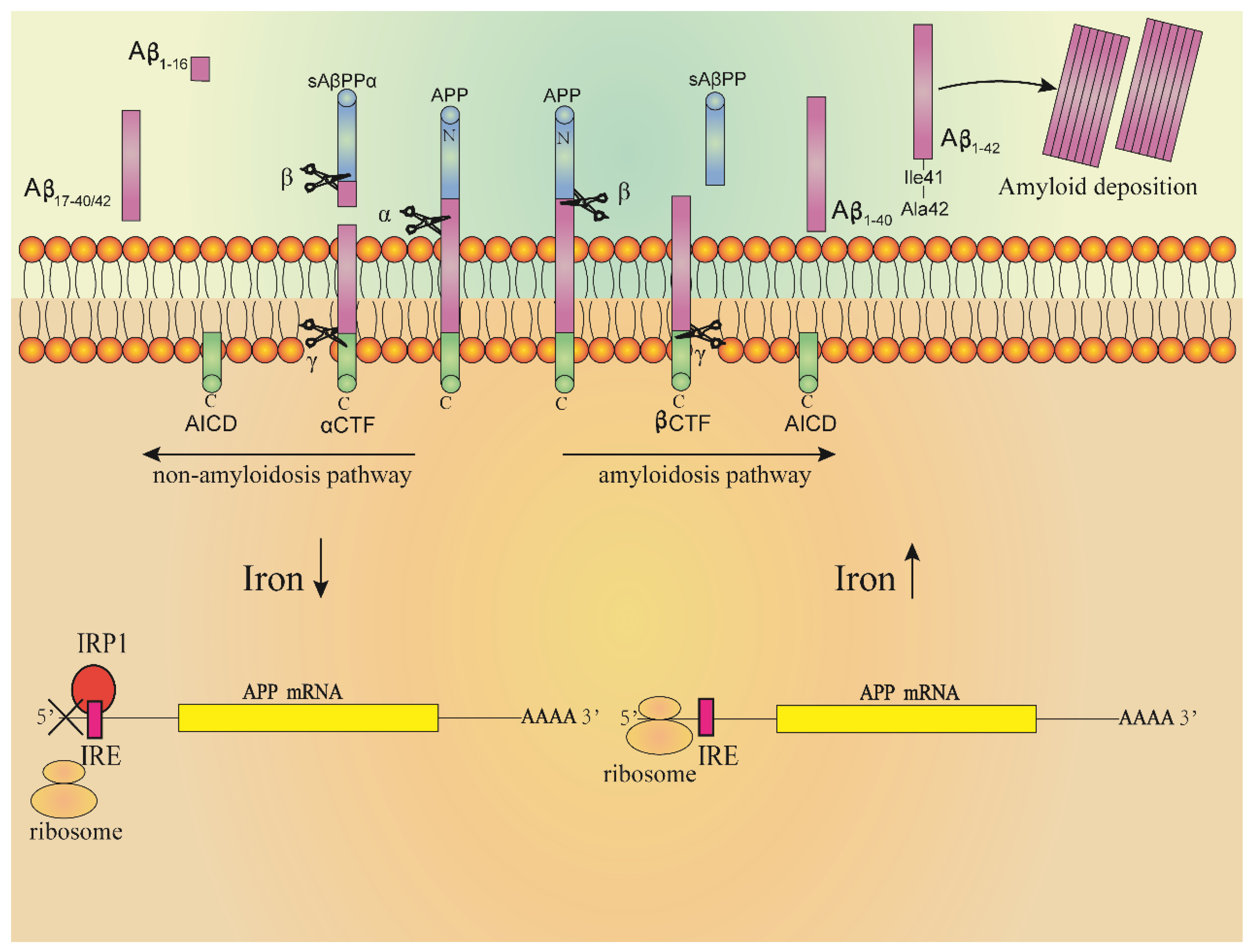 Iron Homeostasis Disorder and Alzheimer’s Disease