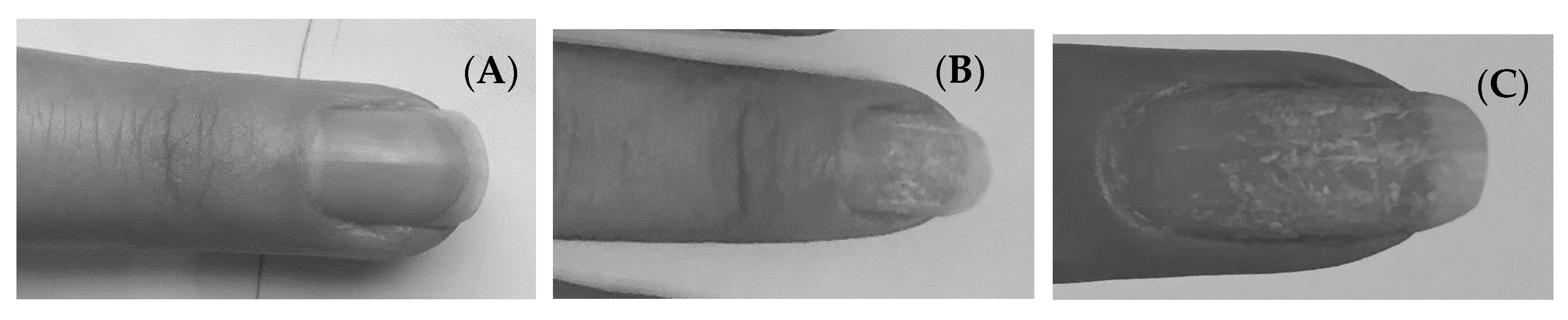 The Influence of UV Varnishes on the Content of Cysteine and Methionine ...