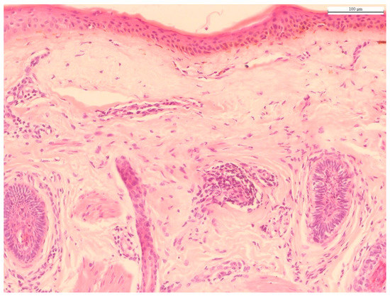 Structural and Functional Changes and Possible Molecular Mechanisms in ...