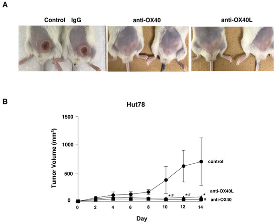 Roles of OX40 and OX40 Ligand in Mycosis Fungoides and Sézary Syndrome