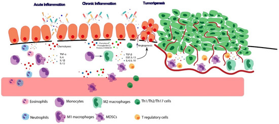 The Role of the Immune System in IBD-Associated Colorectal Cancer: From ...