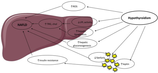 Hypothyroidism-Associated Dyslipidemia: Potential Molecular Mechanisms Leading to NAFLD