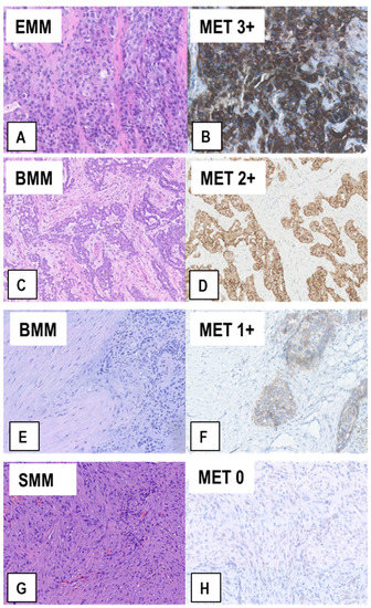 Correlation of MET-Receptor Overexpression with MET Gene Amplification ...