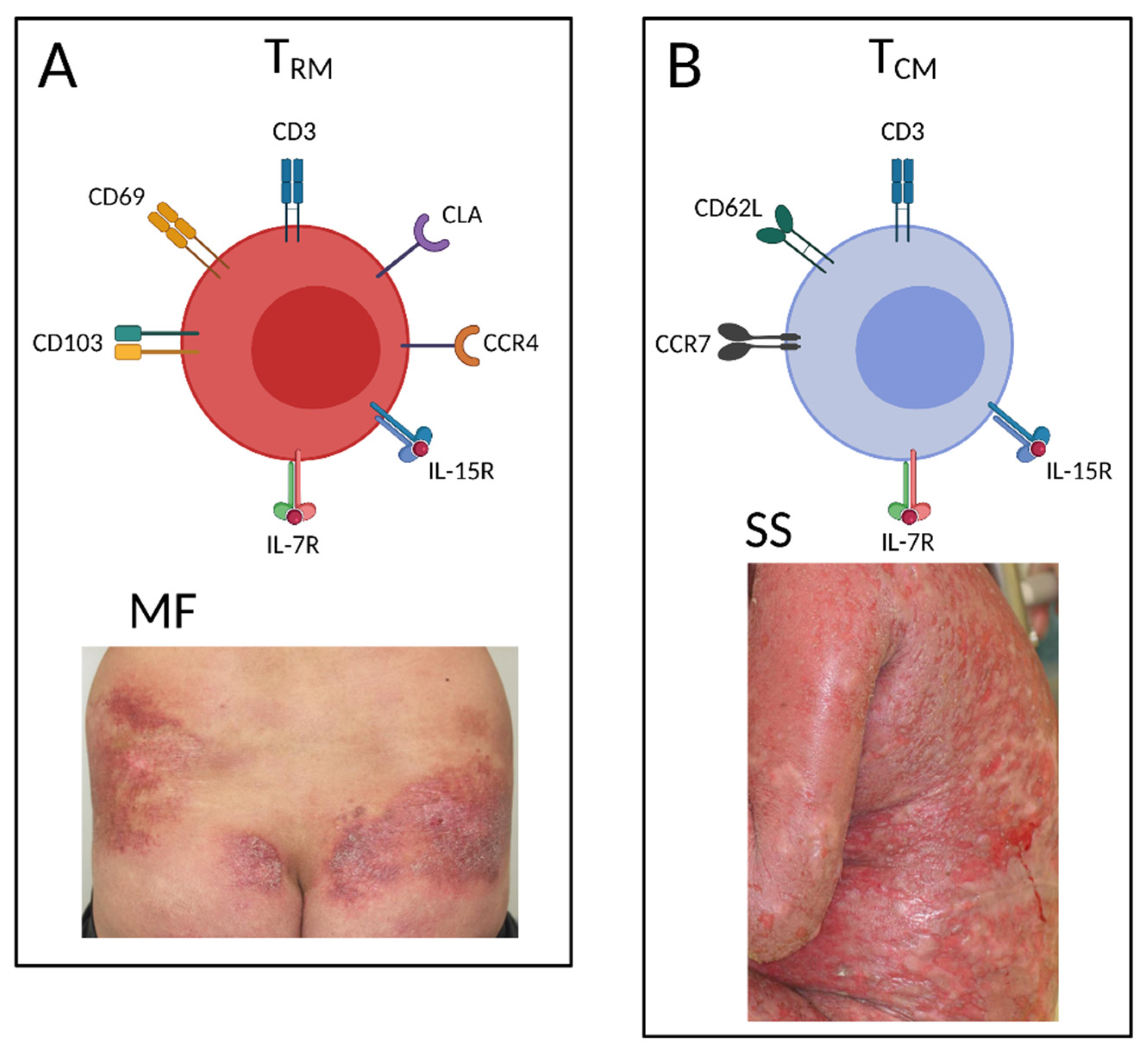 Ijms Free Full Text Malignant And Benign T Cells Constituting