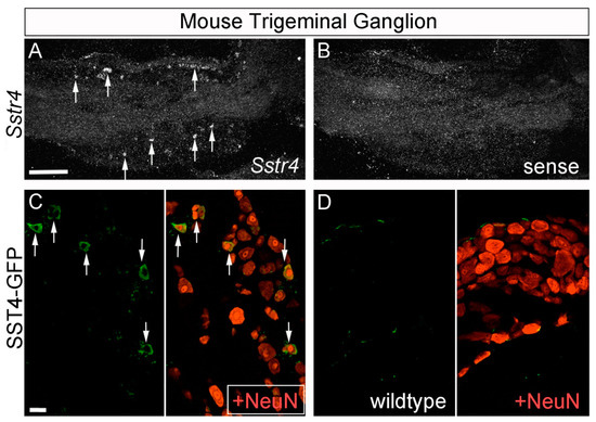 Reassessment of SST4 Somatostatin Receptor Expression Using SST4-eGFP ...