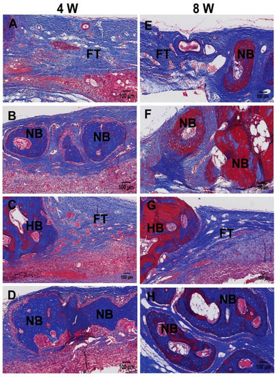 In Vivo Efficacy of Neutrophil-Mediated Bone Regeneration Using a ...