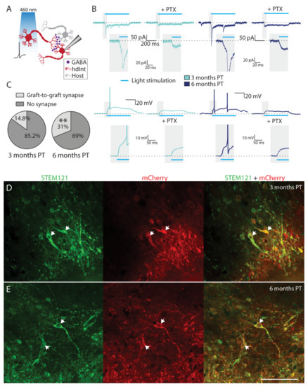 IJMS | Special Issue : Molecular and Cellular Mechanisms of Epilepsy