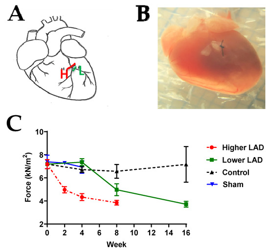 Functional and Molecular Characterisation of Heart Failure Progression ...