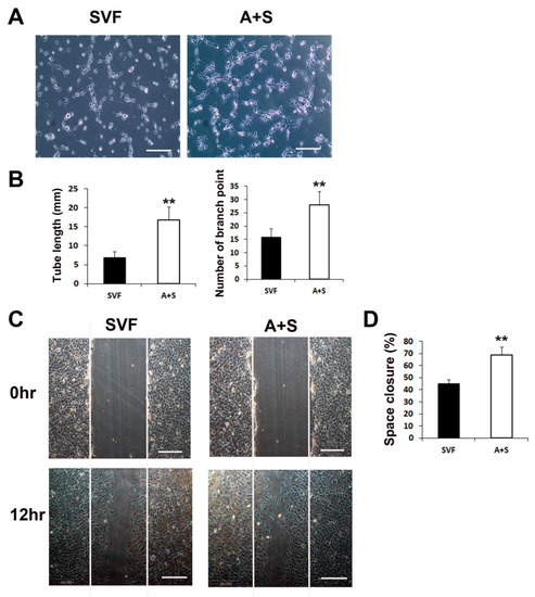 ASC and SVF Cells Synergistically Induce Neovascularization in Ischemic ...