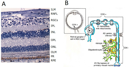 Mitochondrial Retinopathies