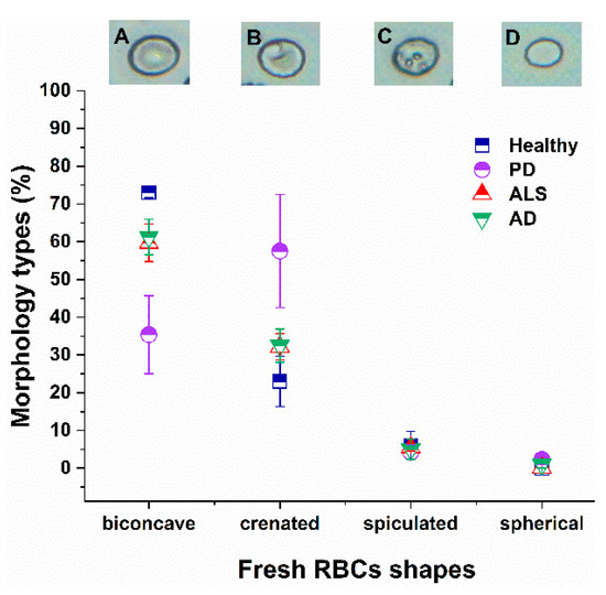 Crenated Red Blood Cells Light Microscope