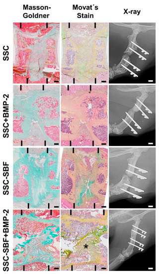 Enhanced BMP-2-Mediated Bone Repair Using an Anisotropic Silk Fibroin ...